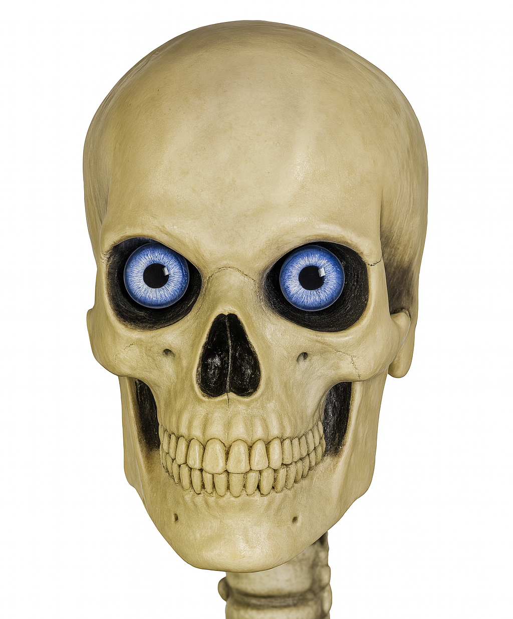 Skelly Brackets and Kits – Secure-A-Skelly